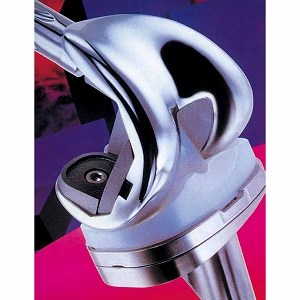 人工膝関節 NexGen® LCCKフェモラルコンポーネント (製造販売企業:ジンマー バイオメット合同会社) | プロダクトデータベース ...