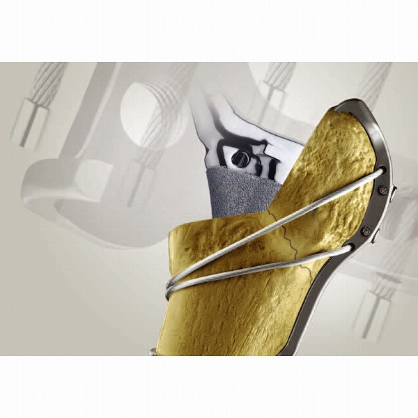 Cable-Ready® インテグラルGTRプレート