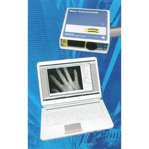 レーザースペックル血流画像化装置 動画モデル MoorFLPI (製造販売企業:ゼロシーセブン株式会社｜製造企業:Moor ...