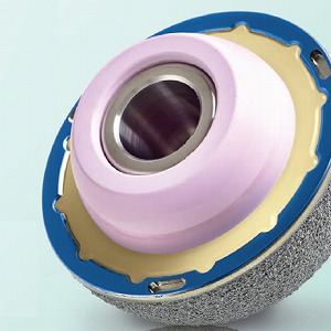 人工股関節 G7 PPS BoneMaster リミテッドホールシェル (製造販売企業:ジンマー バイオメット合同会社) | プロダクト ...