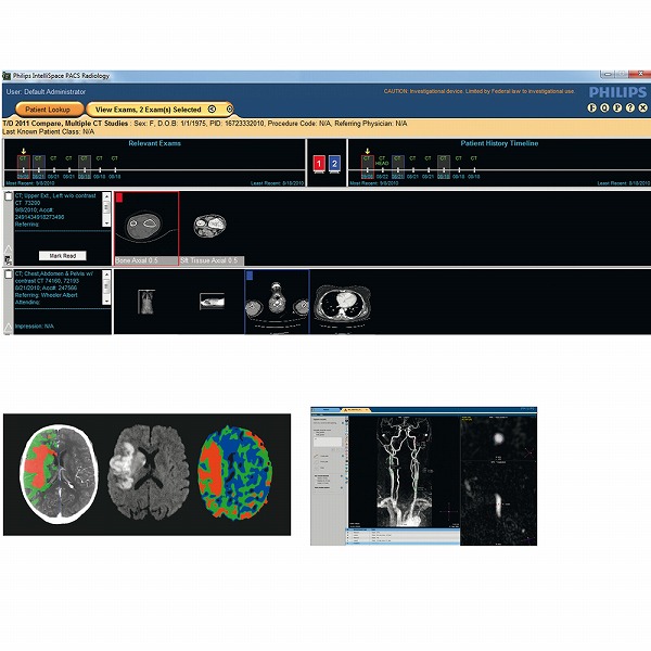 画像診断用ワークステーション IntelliSpace PACS solution | 映像情報Medical