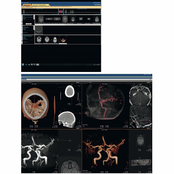 画像診断用ワークステーション IntelliSpace PACS solution | 映像情報Medical