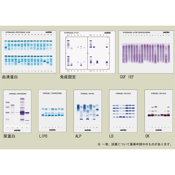 Hydrasys 2 Scan Focusing 多項目電気泳動システム