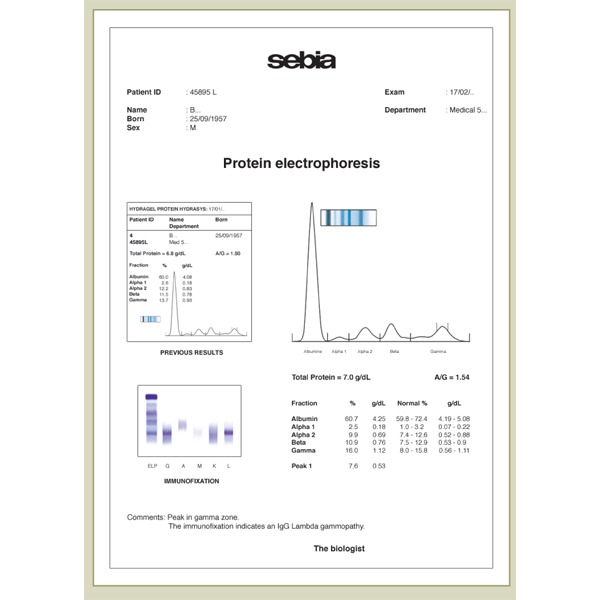 Hydrasys 2 Scan Focusing 多項目電気泳動システム