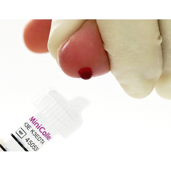 MiniCollect® II(EDTA-3K入り)