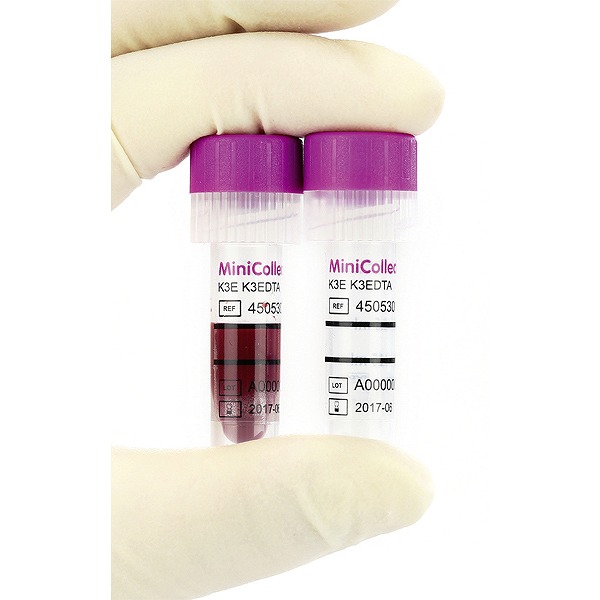 MiniCollect® II(EDTA-2K入り)