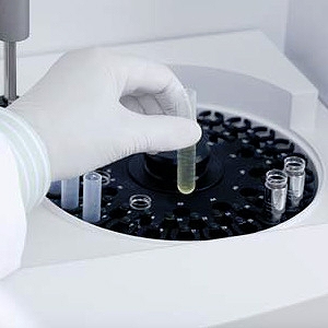 血中薬物濃度自動分析装置 Viva-ProEシステム (製造販売企業:シーメンスヘルスケア・ダイアグノスティクス株式会社) | プロダクト ...