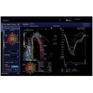 超音波診断装置 Aplio 400 Platinum Series | 映像情報Medical