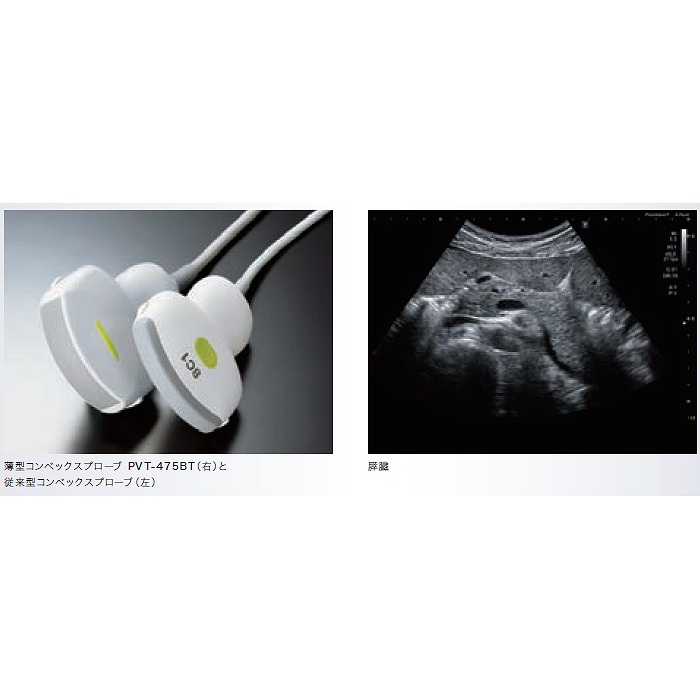 超音波診断装置 Aplio a550 | 映像情報Medical