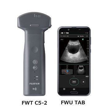 超音波画像診断装置 iViz air コンベックス
