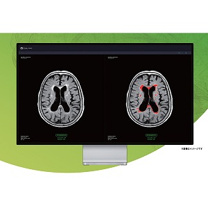 EIRL Brain Metry (製造販売企業:エルピクセル株式会社) | プロダクトデータベース-メディカルオンライン-