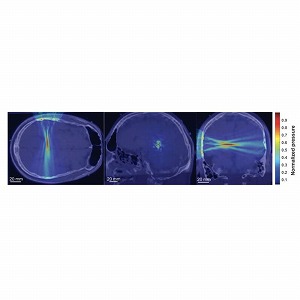 集束超音波刺激装置 NEUROFUS PRO™ (販売企業:株式会社ミユキ技研｜製造企業:Sonic Concepts社(アメリカ)｜販売企業:BRAINBOX社(イギリス)) | プロダクト ...