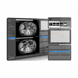 Myrian用CT, MRI, CT/MRI オプション TumorBoard (販売企業:株式会社東陽テクニカ) | プロダクトデータベース-メディカルオンライン-