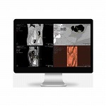 Myrian用CTオプション Colon (販売企業:株式会社東陽テクニカ) | プロダクトデータベース-メディカルオンライン-