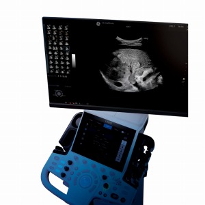 超音波画像診断装置 LOGIQ P10 Series (製造販売企業:GEヘルスケア・ジャパン株式会社) | プロダクトデータベース ...