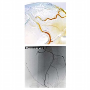 HEARTROID CTO Model (製造販売企業:株式会社JMC) | プロダクトデータベース-メディカルオンライン-