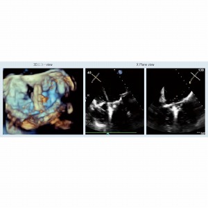HEARTROID MV Model (製造販売企業:株式会社JMC) | プロダクトデータベース-メディカルオンライン-