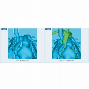 HEARTROID TPVI Model (製造販売企業:株式会社JMC) | プロダクトデータベース-メディカルオンライン-